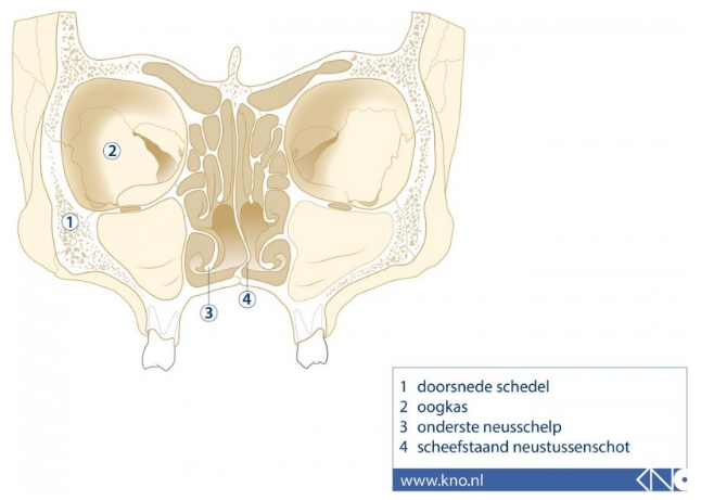 Neusschelp verkleining - Tergooi MC