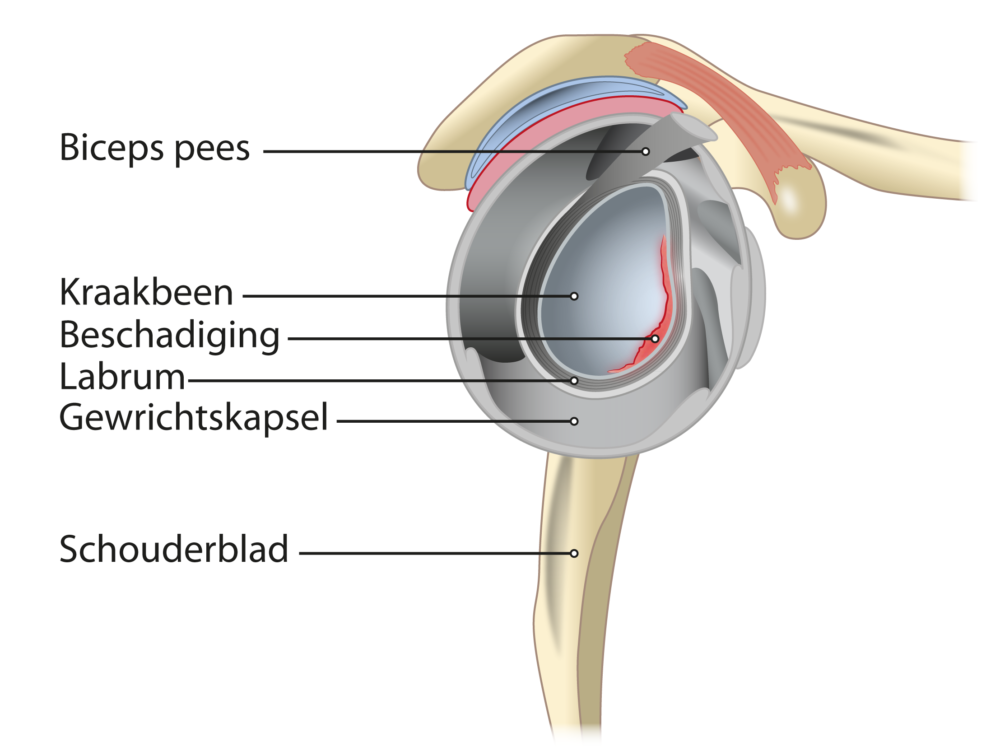 Schouderinstabiliteit - Tergooi MC