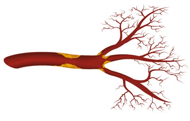 Coronaire functietest (CFT) - Tergooi MC