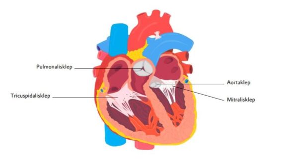 Hartklepaandoening - Tergooi MC